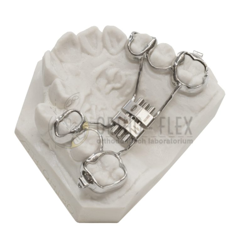 Geprinte Hyrax op 4 banden - Ortho-Flex